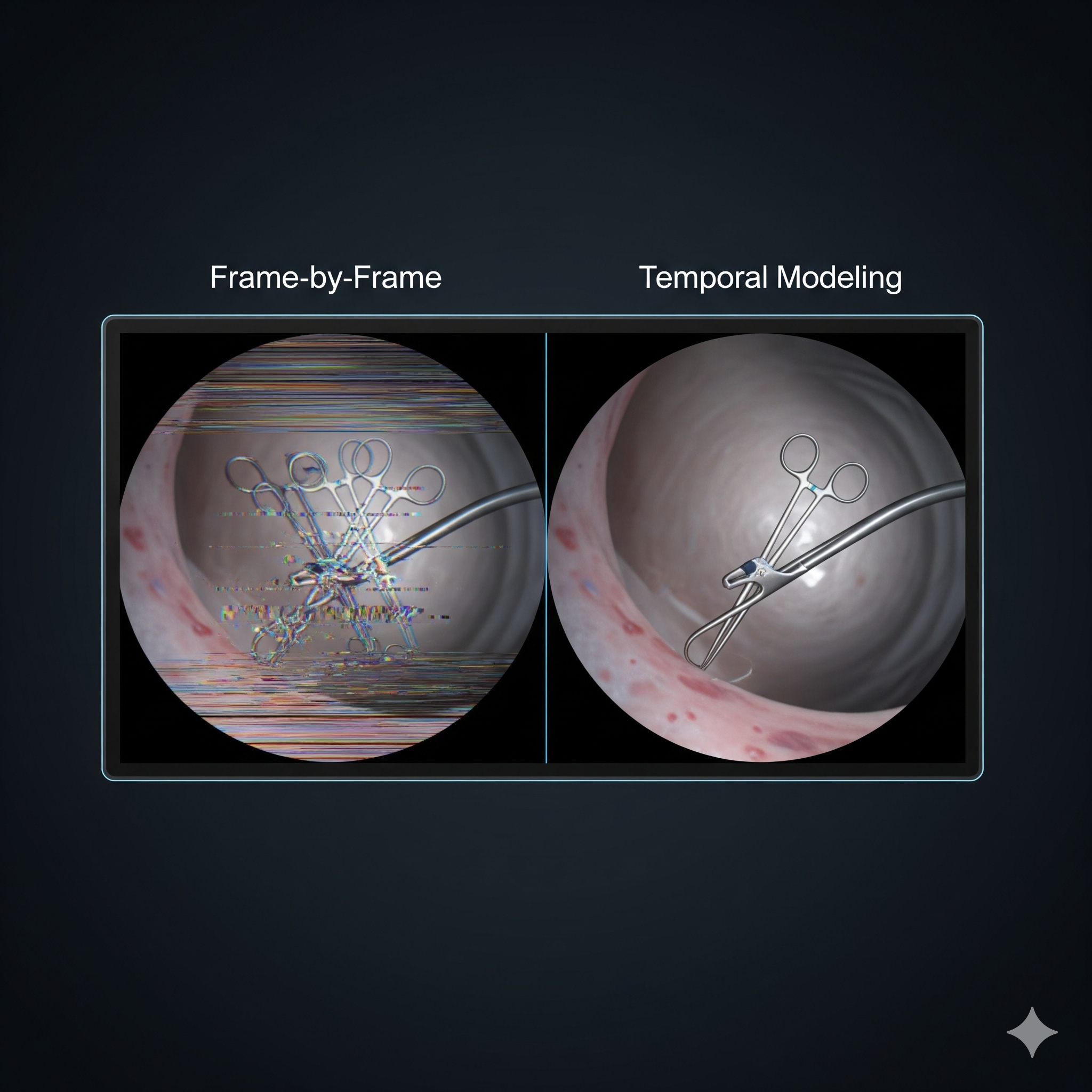 Temporal Modeling in Surgical Video: Addressing Frame-by-Frame ...